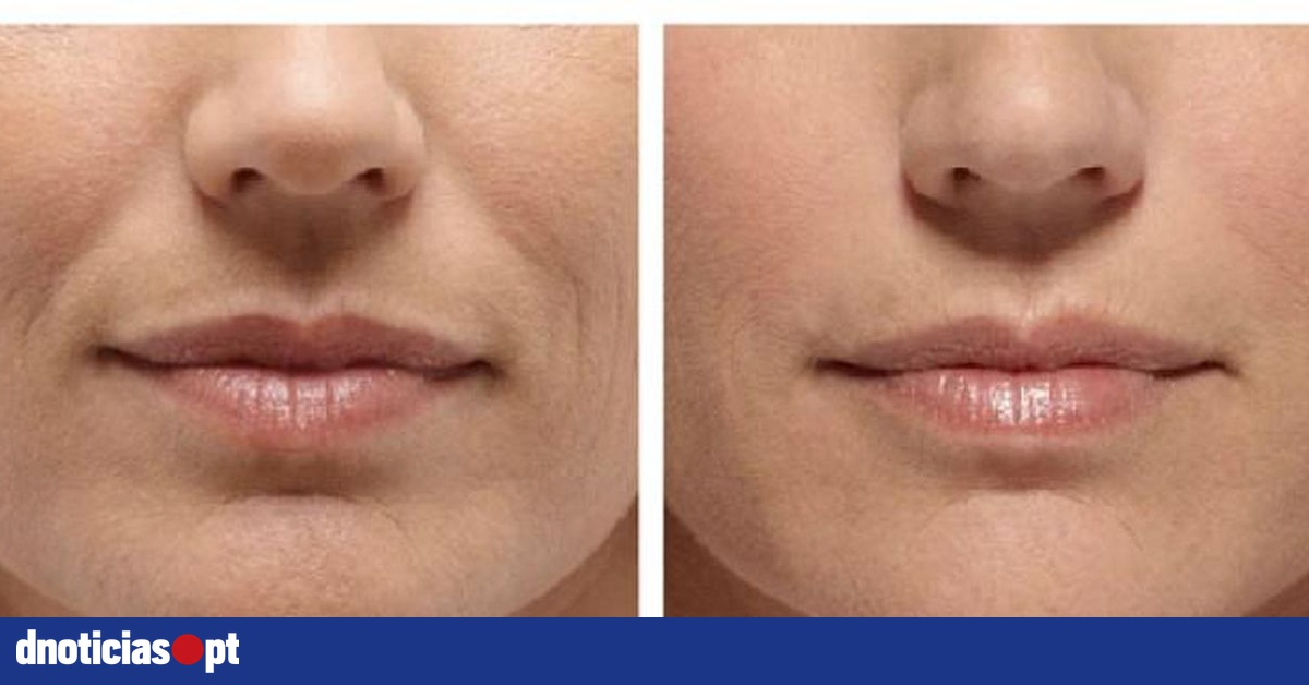 Why Dark Line Around Lips | Lipstutorial.org